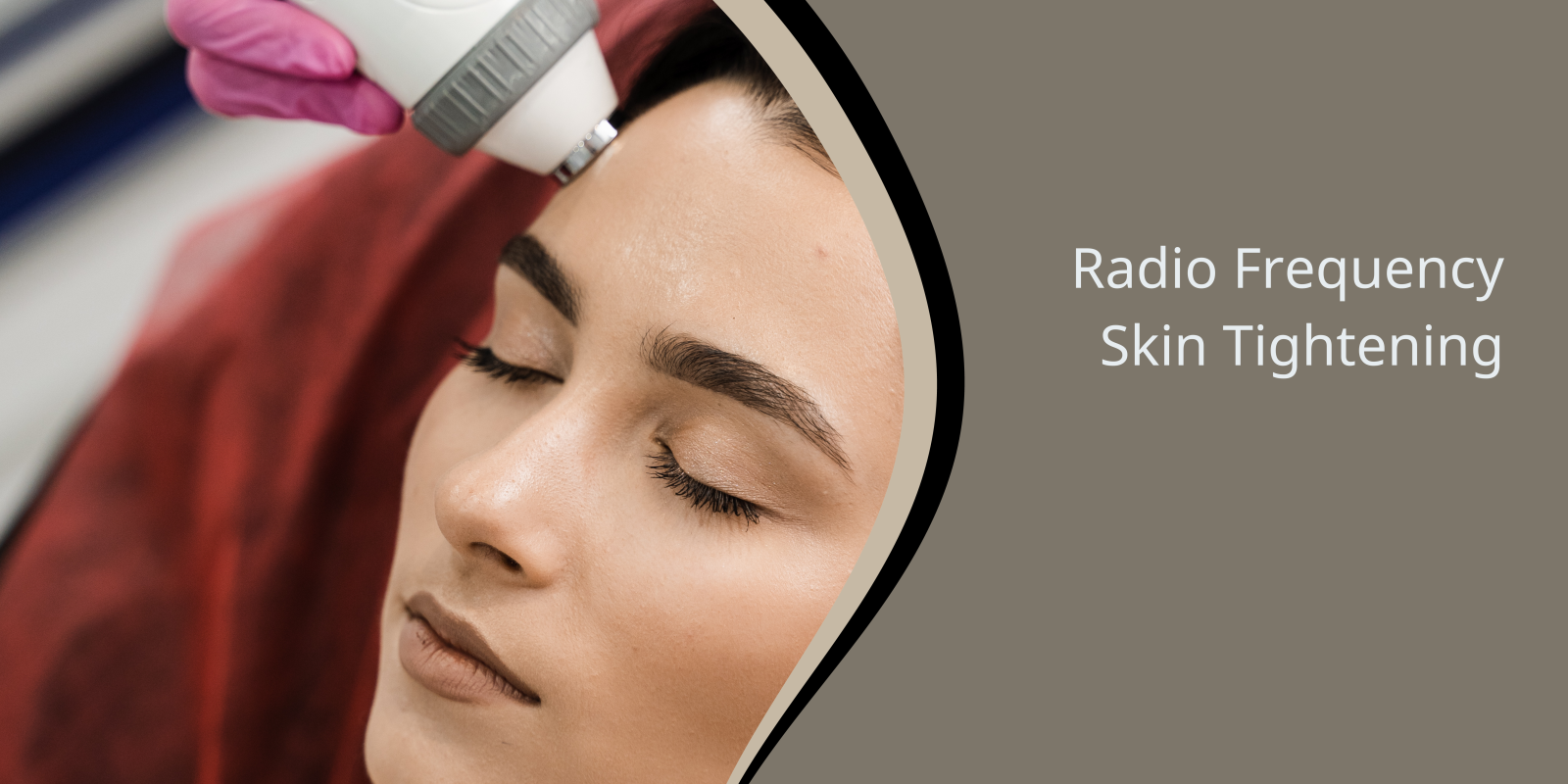 Sunshine Coast Cosmetic Clinic - Radio Frequency Skin Tightening: A Non ...